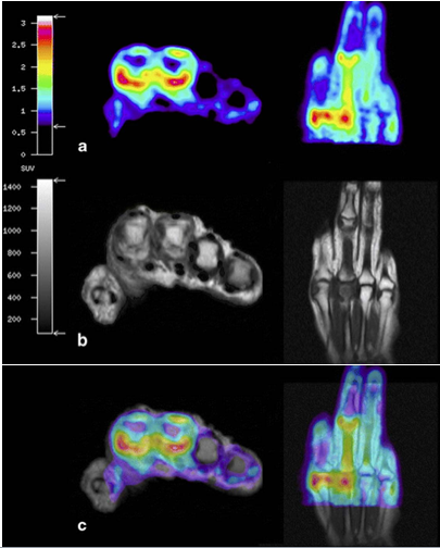 PET/MRI - MRC